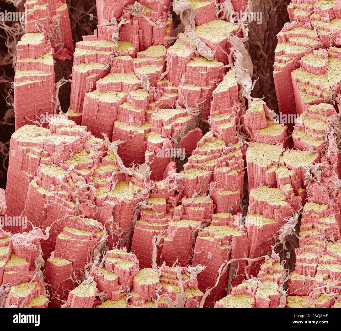 Muscle fibre. Coloured scanning electron micrograph (SEM) of a freeze-fractured skeletal (or ...