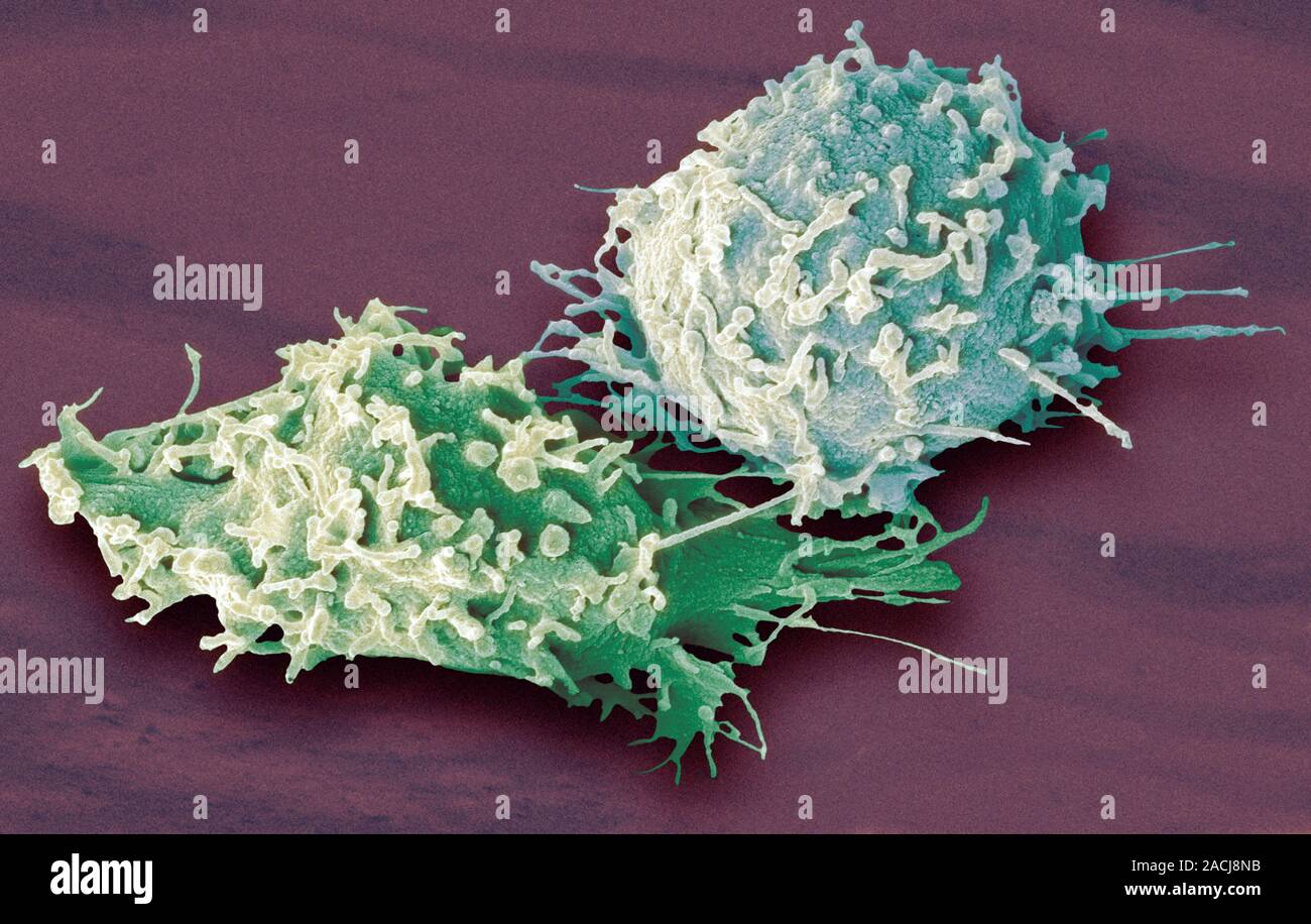 Macrophage cells. Coloured scanning electron micrograph (SEM) of ...