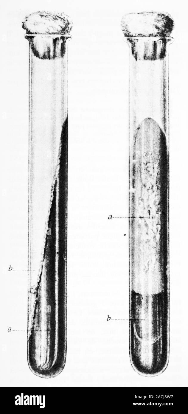 Tuberculosis cultures. 1882 diagram of test tubes containing ...
