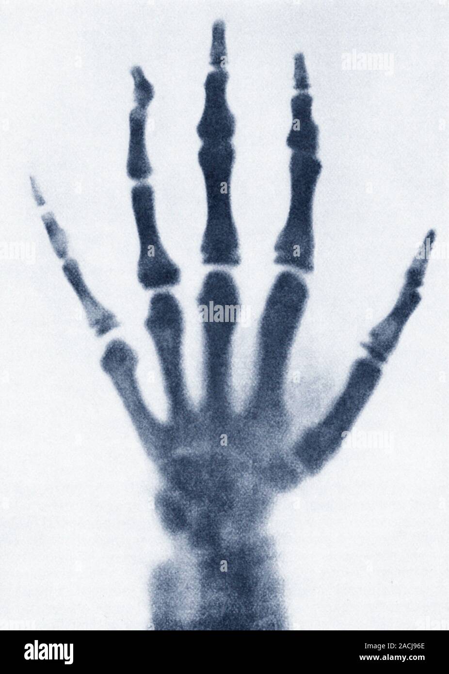 In 1895 Roentgen discovered a new kind of radiant energy which he named ...