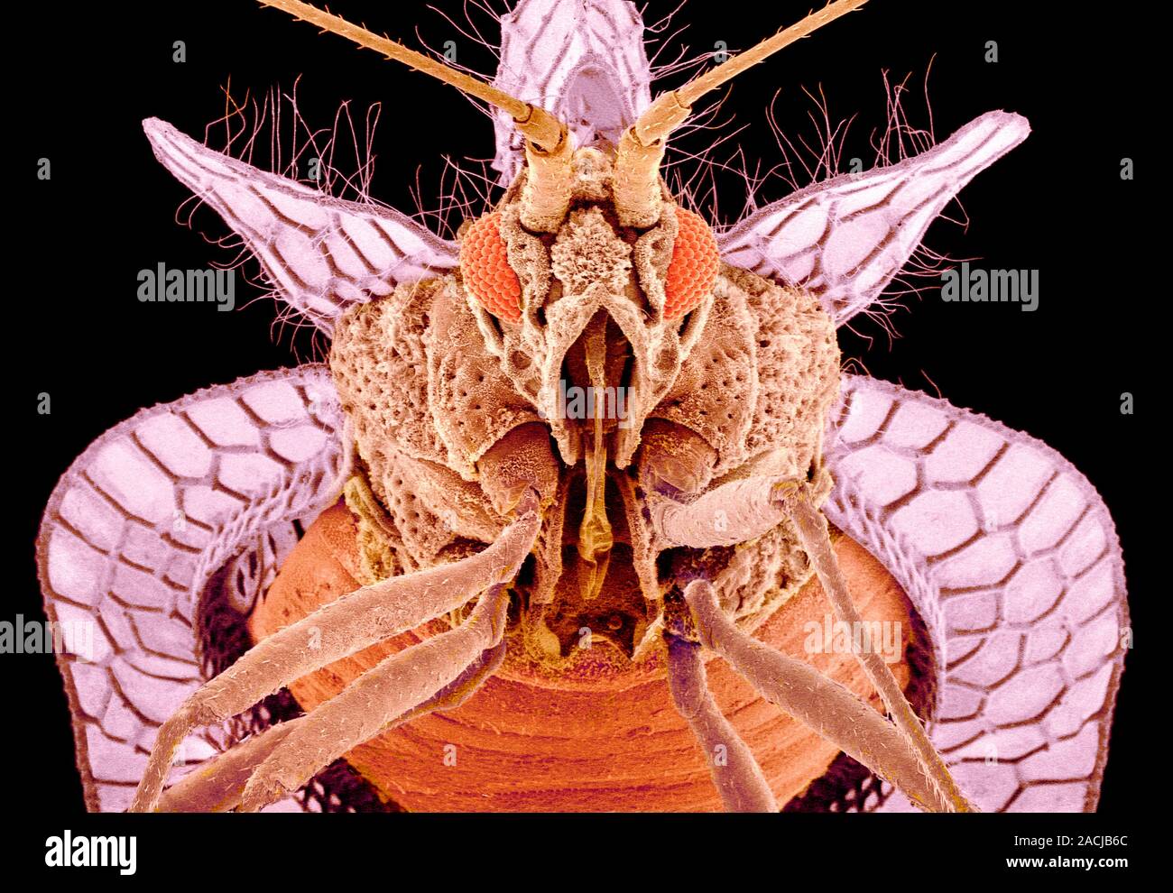 Lace bug. Coloured scanning electron micrograph (SEM) of the upper body ...