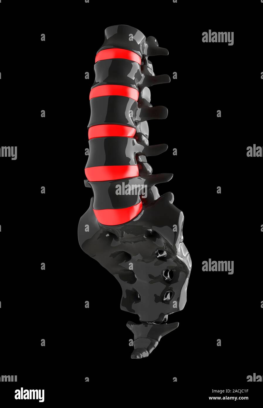 Artwork of the five lumbar (lower back) vertebrae and sacrum (at bottom ...