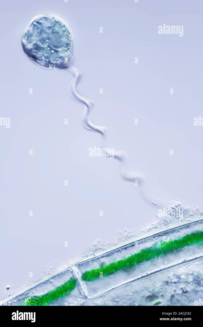 Vorticella protozoa. Differential interference contrast micrograph of a ...