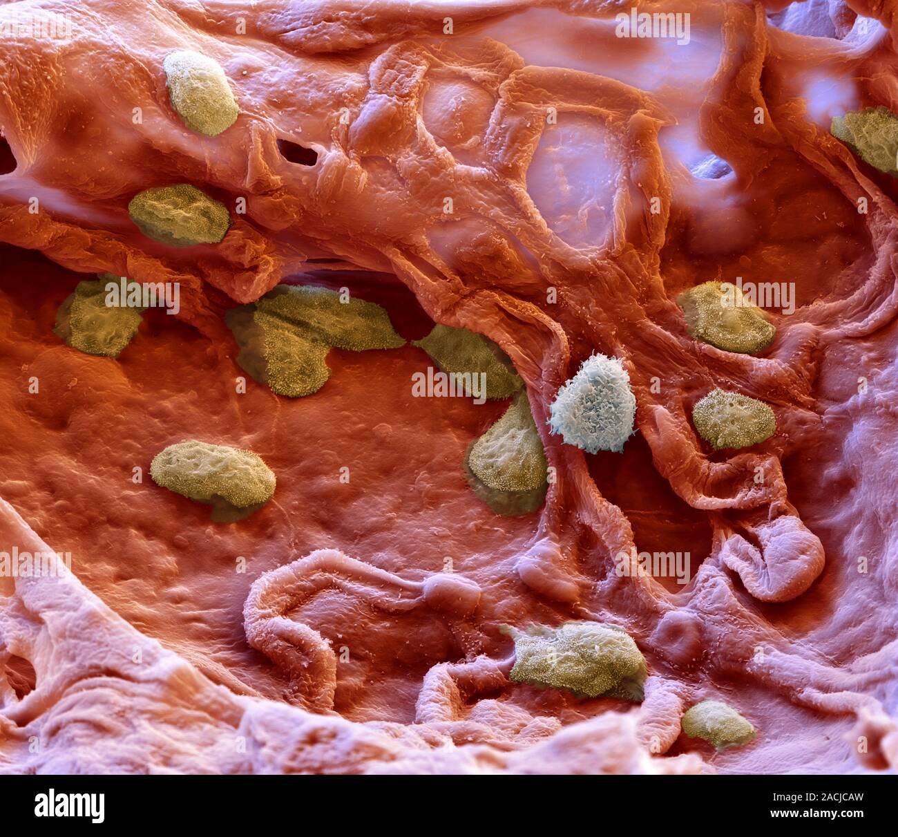 Alveolar macrophage. Coloured scanning electron micrograph (SEM) of an ...