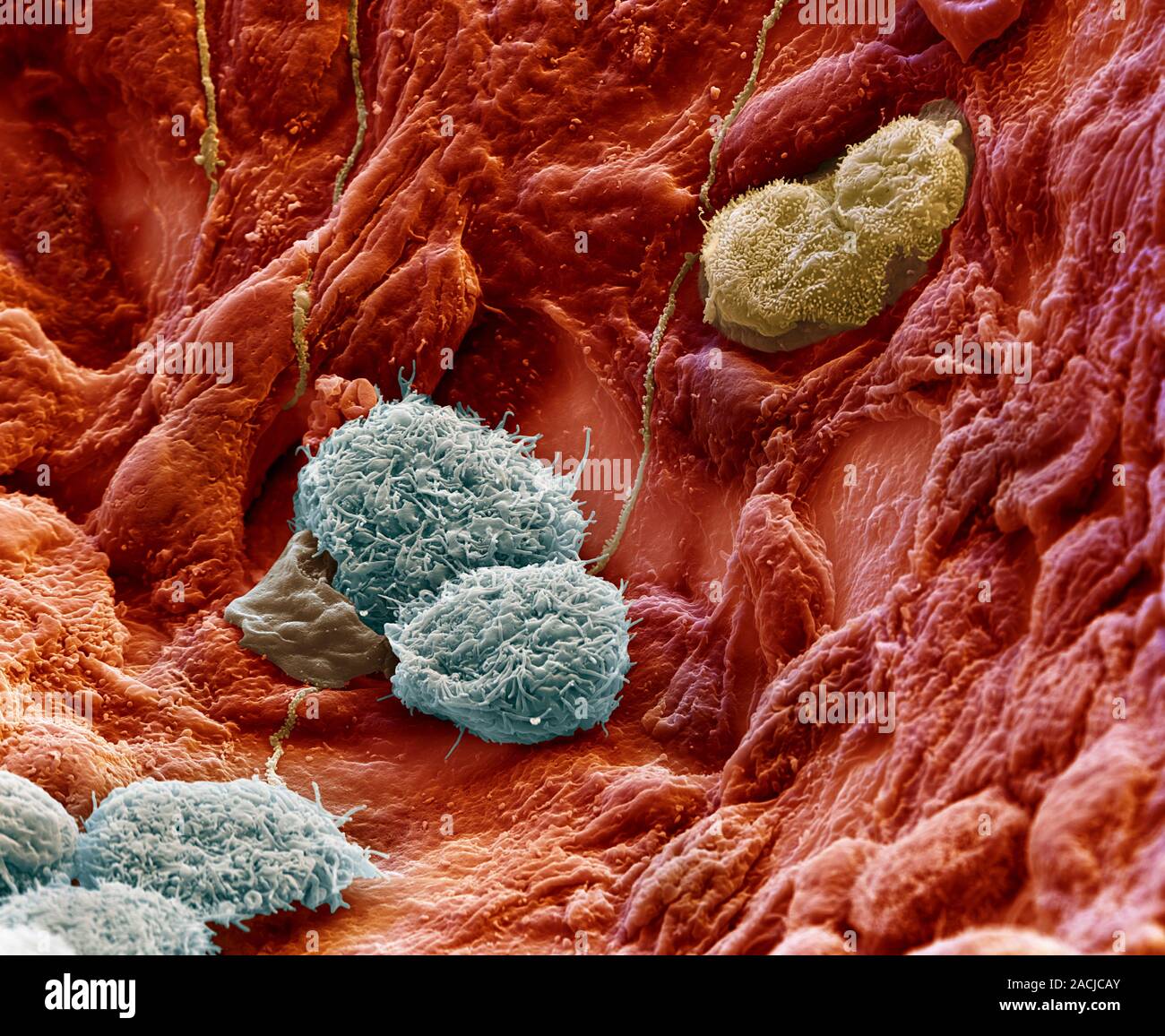 Alveolar macrophages. Coloured scanning electron micrograph (SEM) of ...