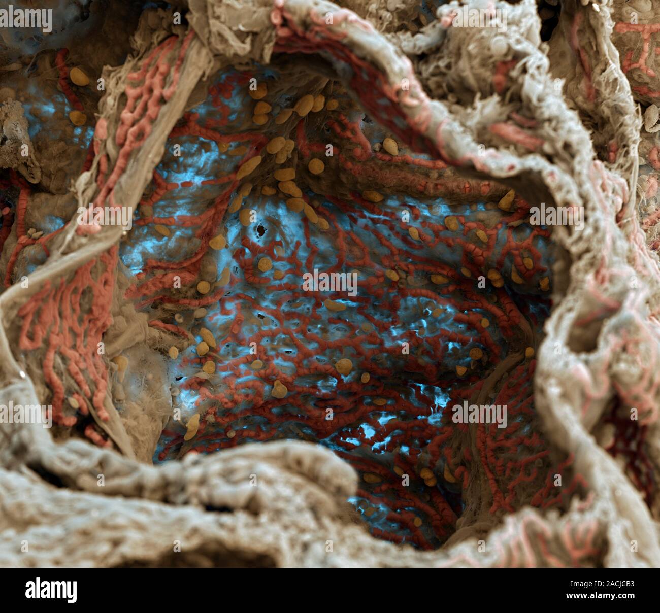 Lung capillaries. Coloured scanning electron micrograph (SEM) of a ...