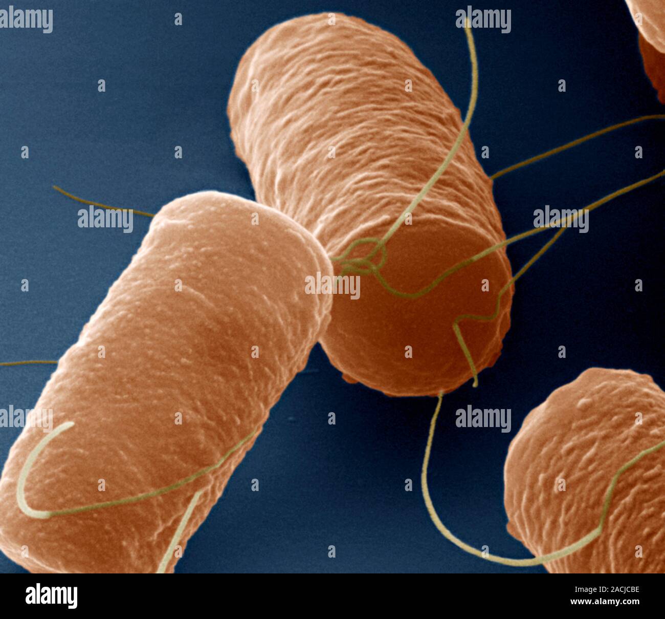 Bacillus cereus bacteria, coloured scanning electron micrograph (SEM ...