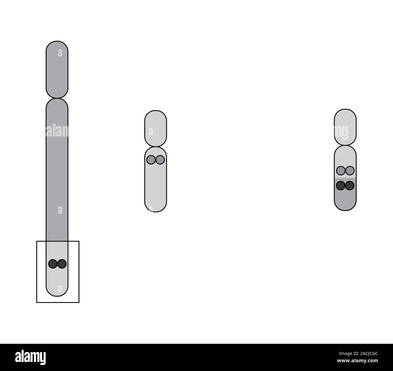 Artwork of Philadelphia chromosome, a genetic defect that causes the ...