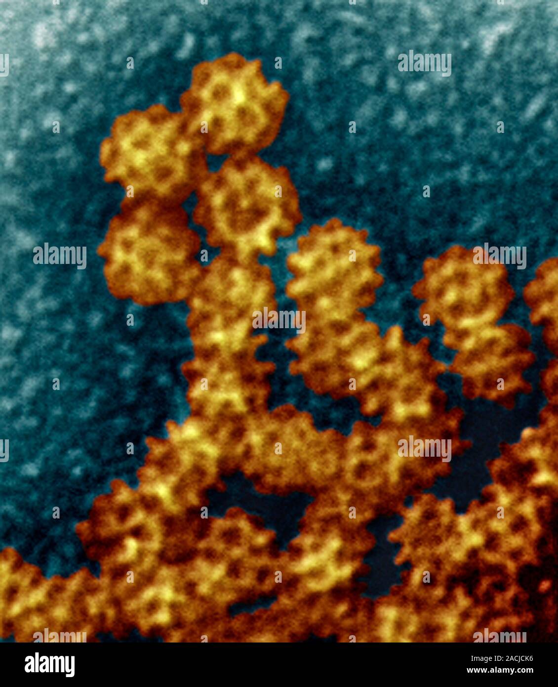 Caliciviridae virus particles, coloured transmission electron ...
