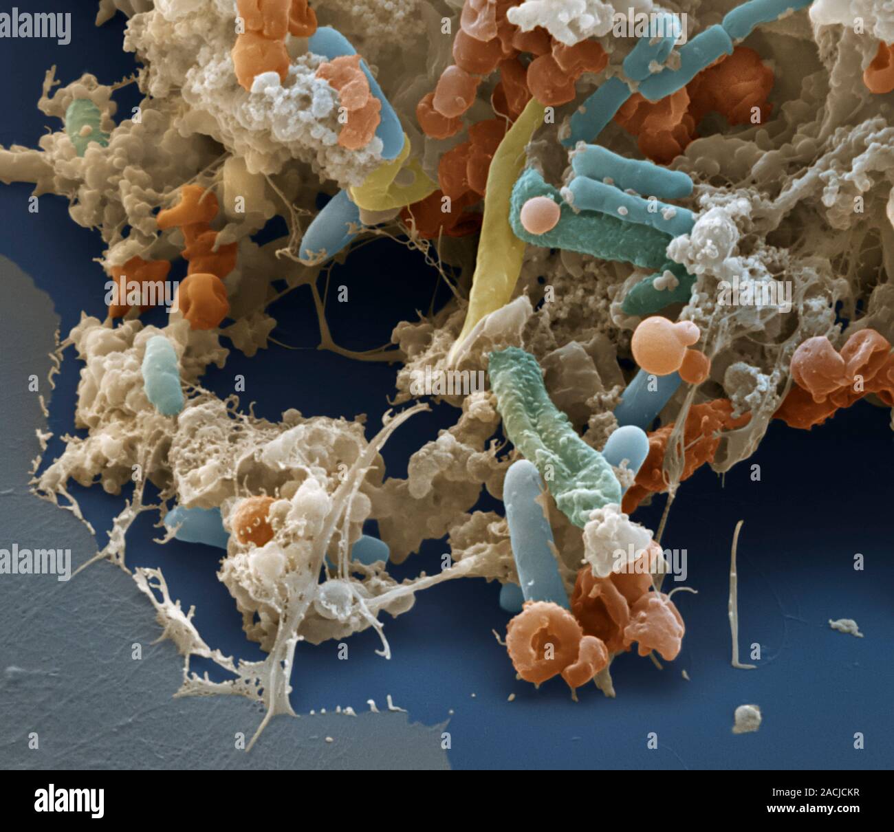 Dechlorinating bacteria. Coloured scanning electron micrograph (SEM) of ...