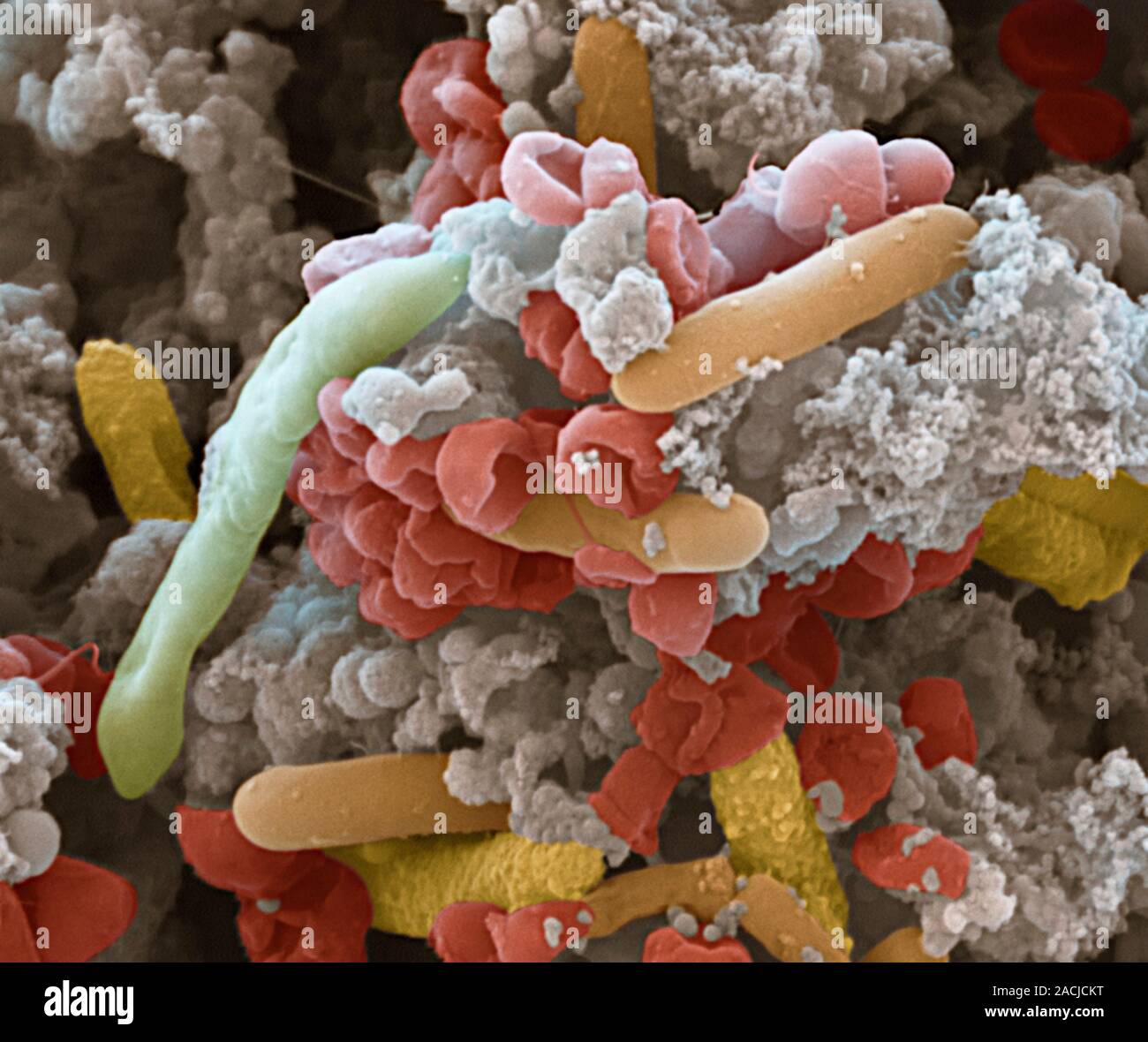 Dechlorinating bacteria. Coloured scanning electron micrograph (SEM) of ...