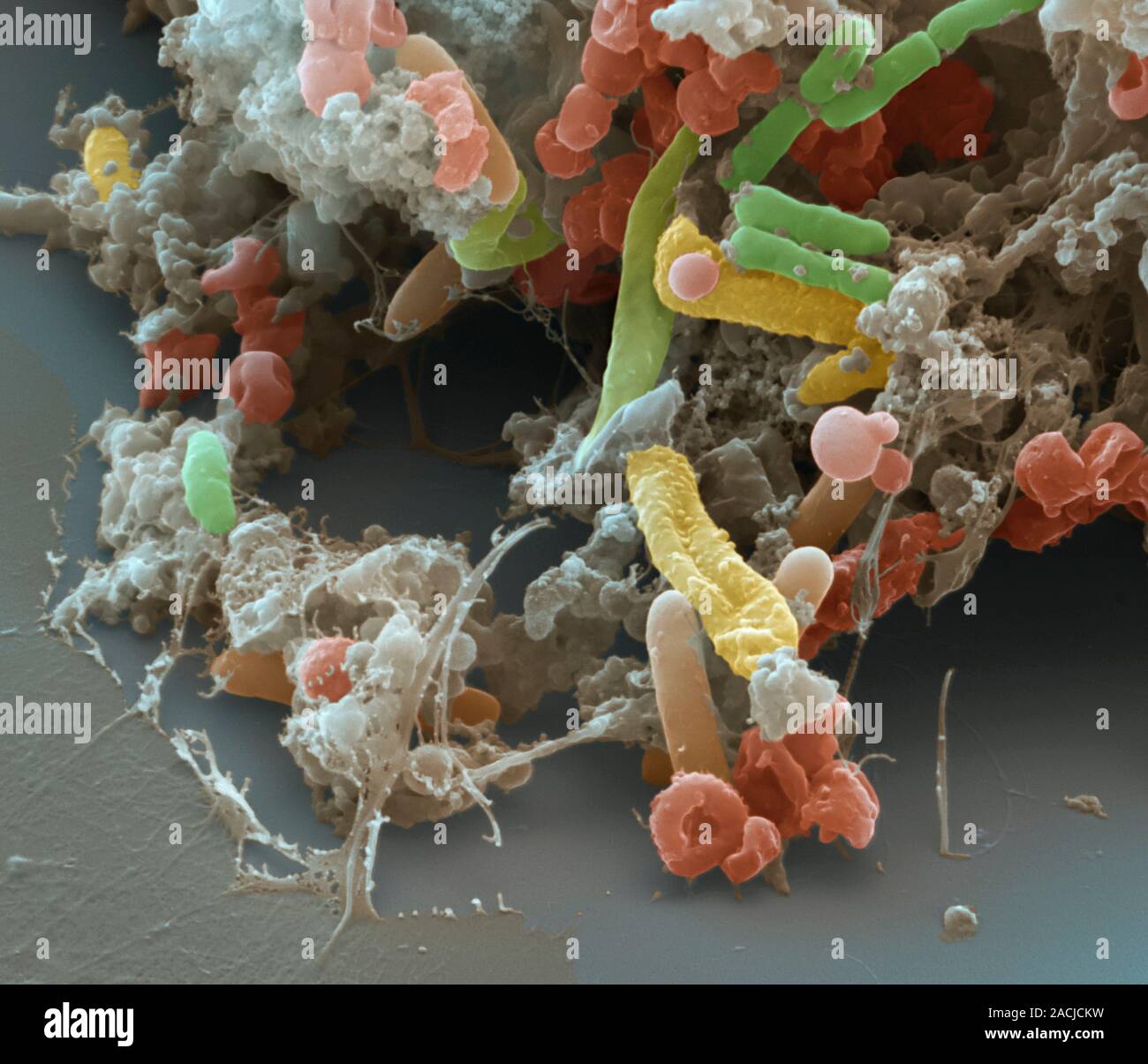 Dechlorinating bacteria. Coloured scanning electron micrograph (SEM) of ...