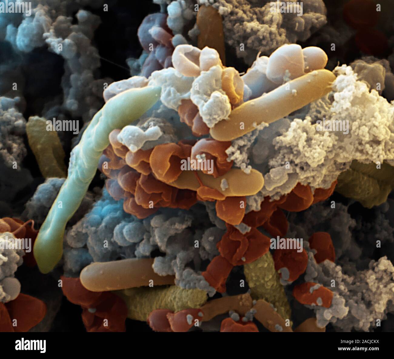 Dechlorinating bacteria. Coloured scanning electron micrograph (SEM) of ...
