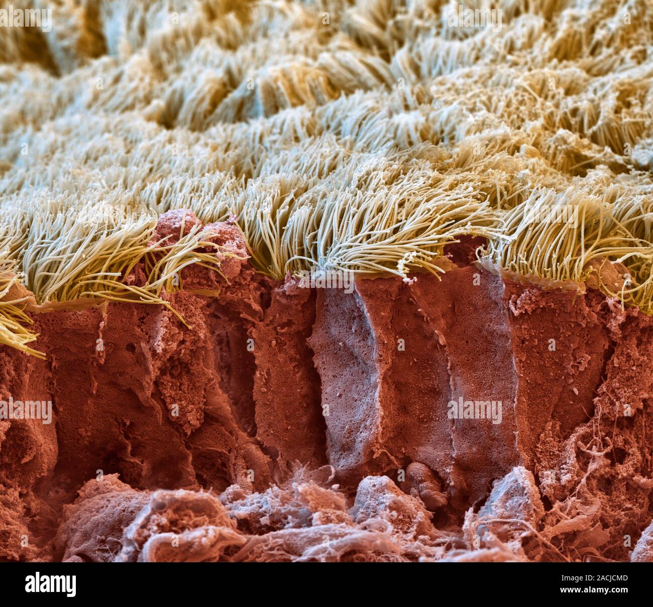 Lung lining. Coloured scanning electron micrograph (SEM) of a section ...