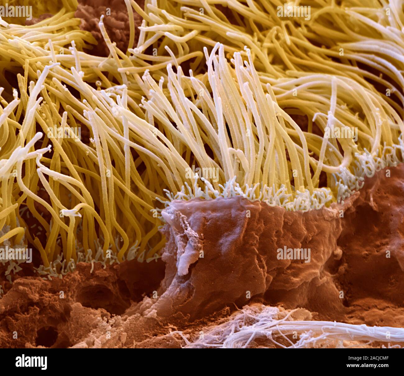 Lung lining. Coloured scanning electron micrograph (SEM) of a section ...