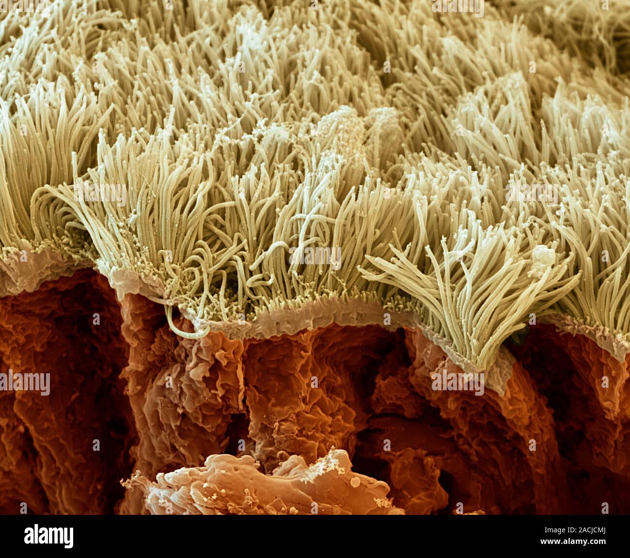 Lung lining. Coloured scanning electron micrograph (SEM) of a section ...