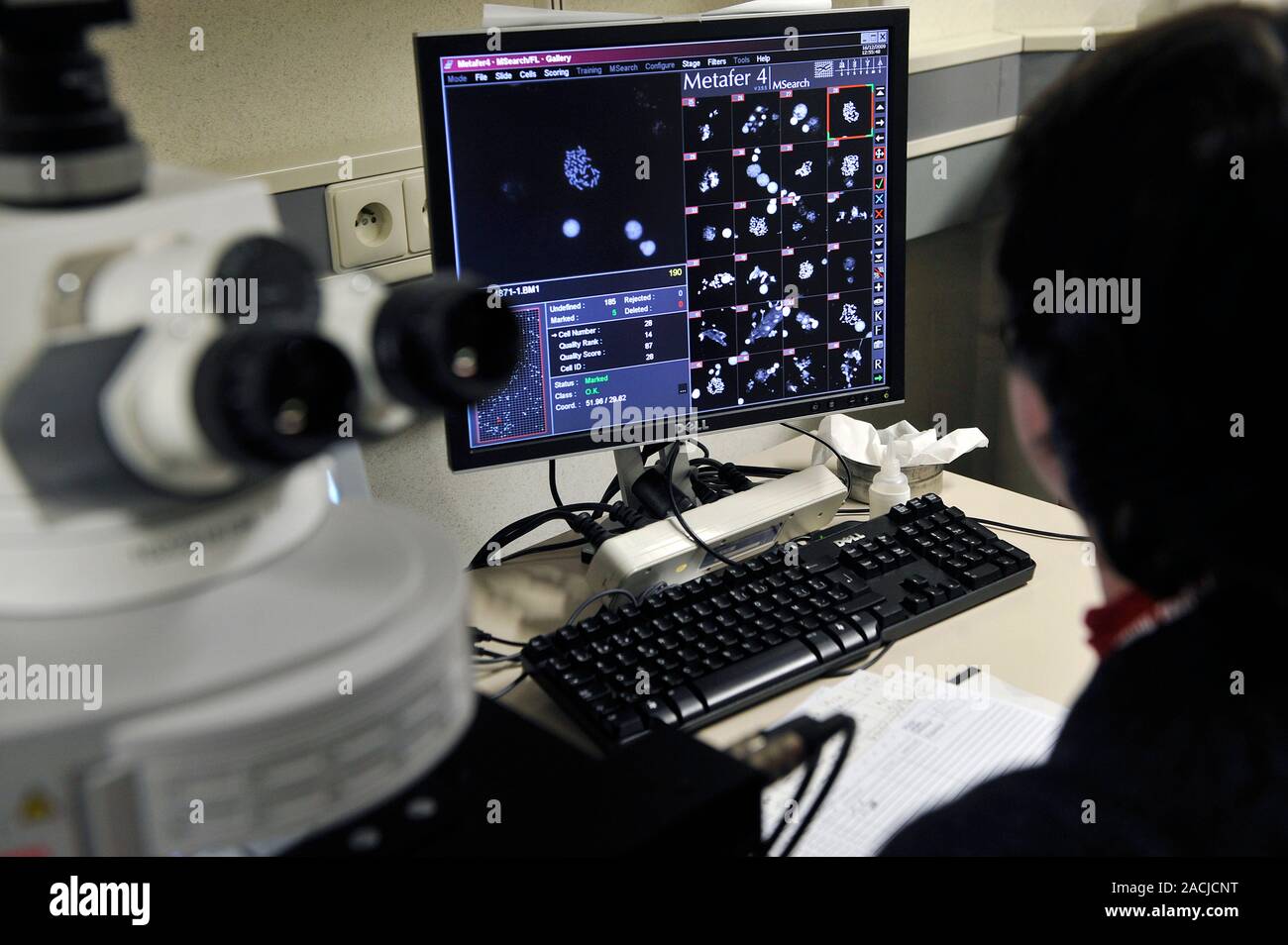 Cell analysis program. Medical worker using the Metafer computer ... Cell analysis program. Medical worker using the Metafer computer ...