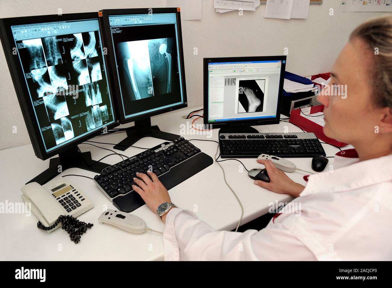Radiologist assessing X-rays. Radiologist examining X-rays displayed on ...