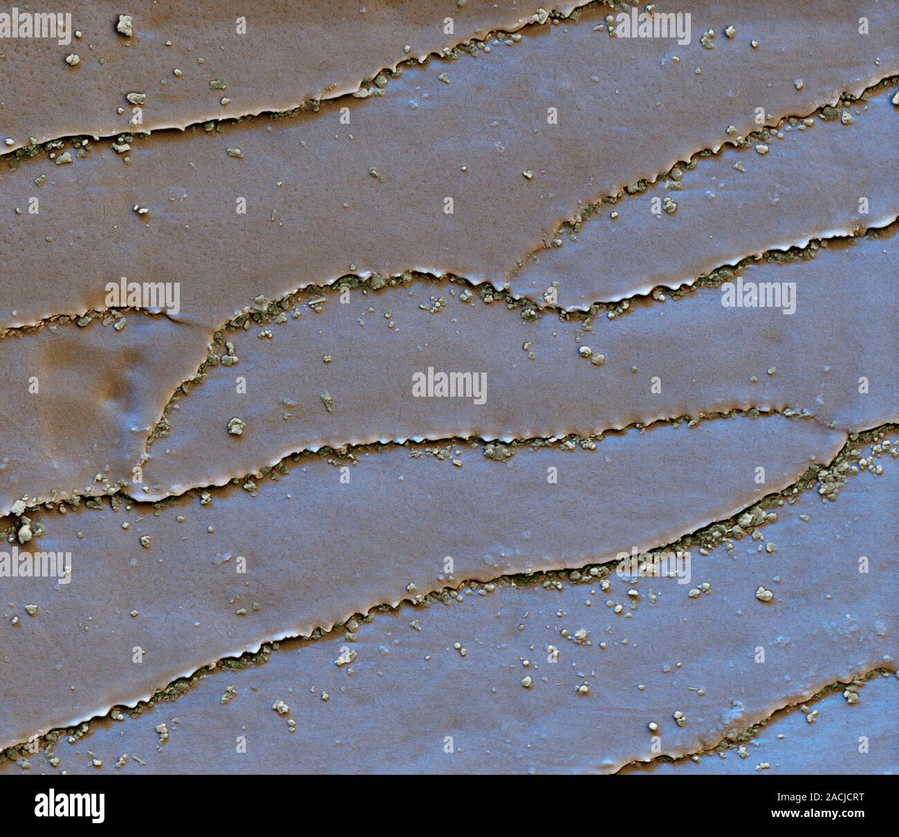 Sand skink skin. Coloured scanning electron micrograph (SEM) of the ...
