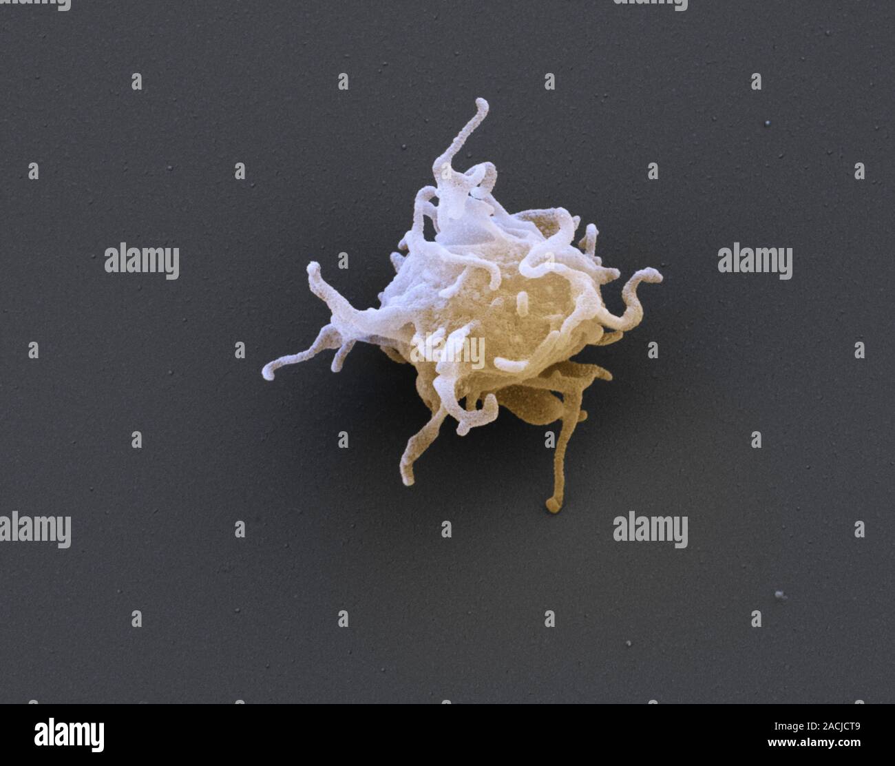 Activated platelet. Coloured scanning electron micrograph (SEM) of an ...