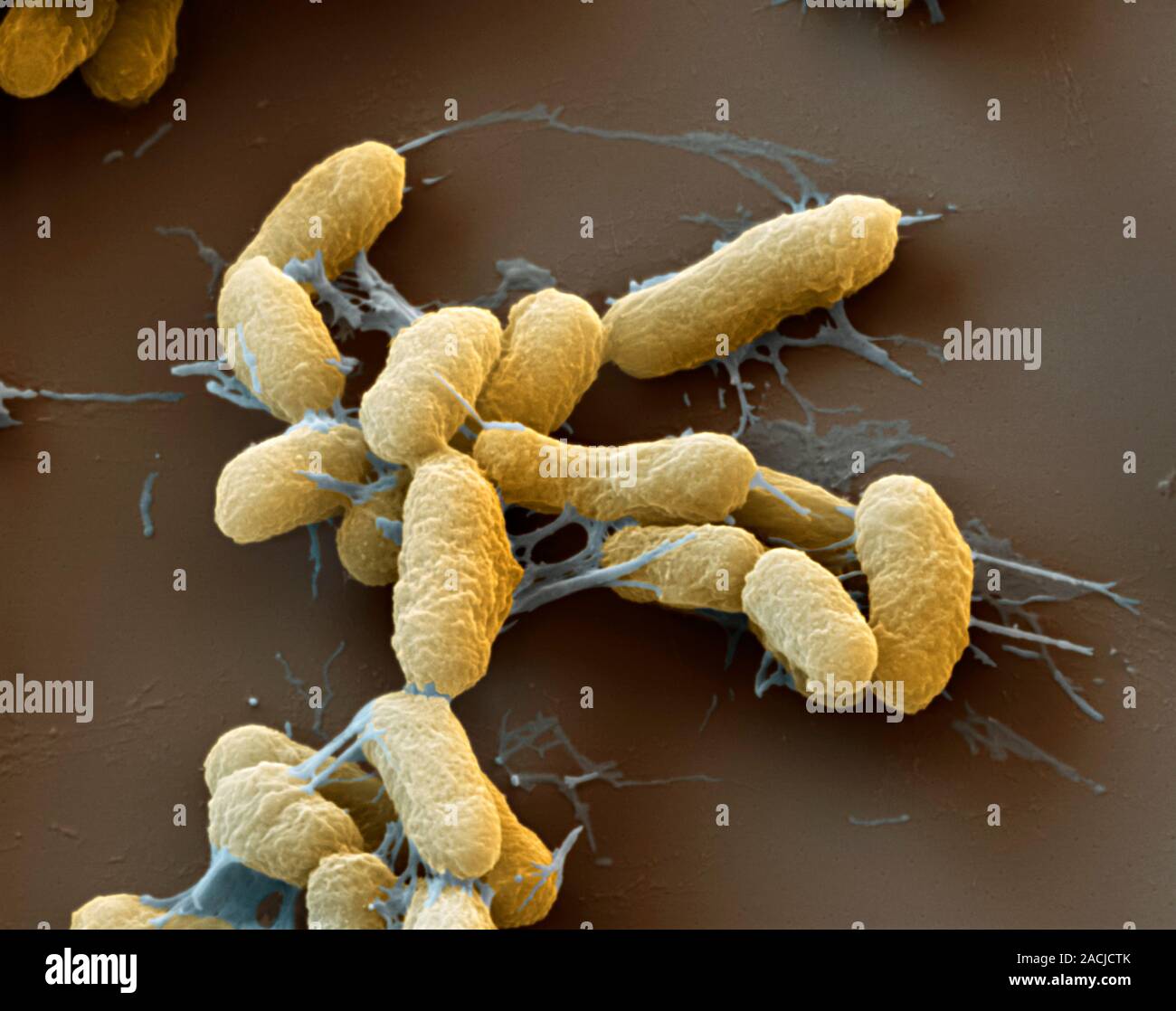 Yersinia Pestis The Plague / Black Death