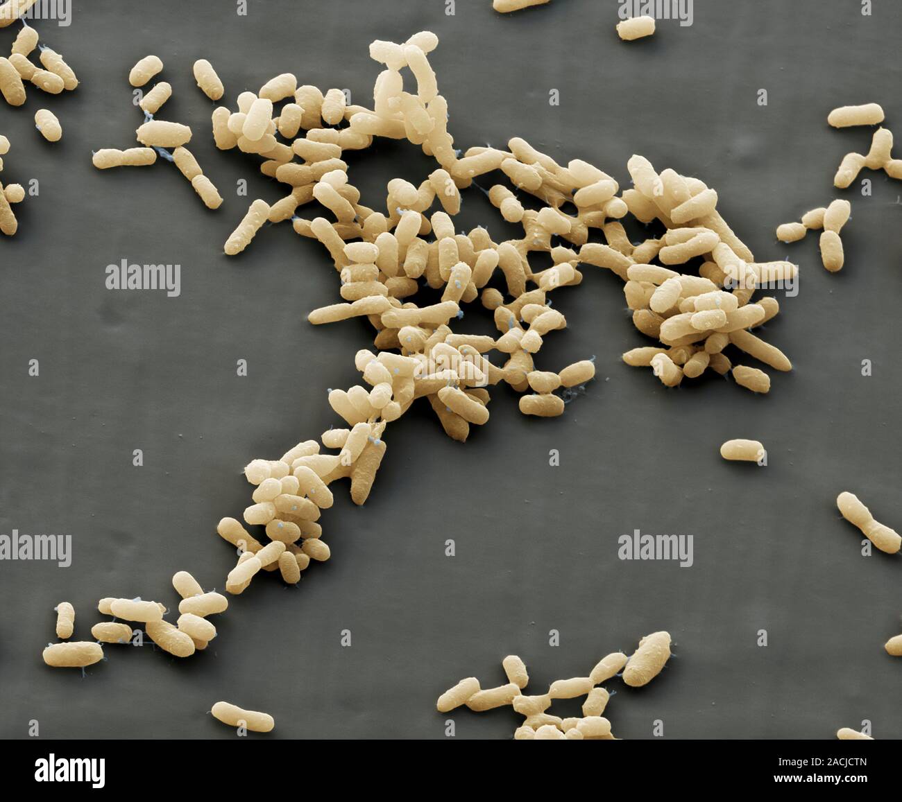 Plague bacteria (Yersinia pestis), coloured scanning electron ...