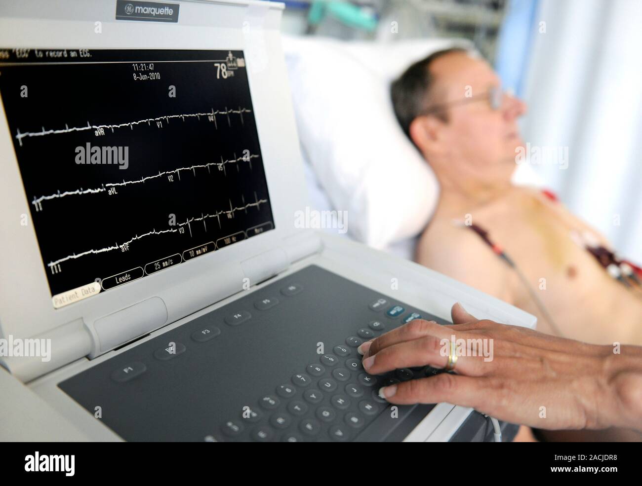 Heart monitoring. Screen showing a patient's electrocardiography (ECG ...