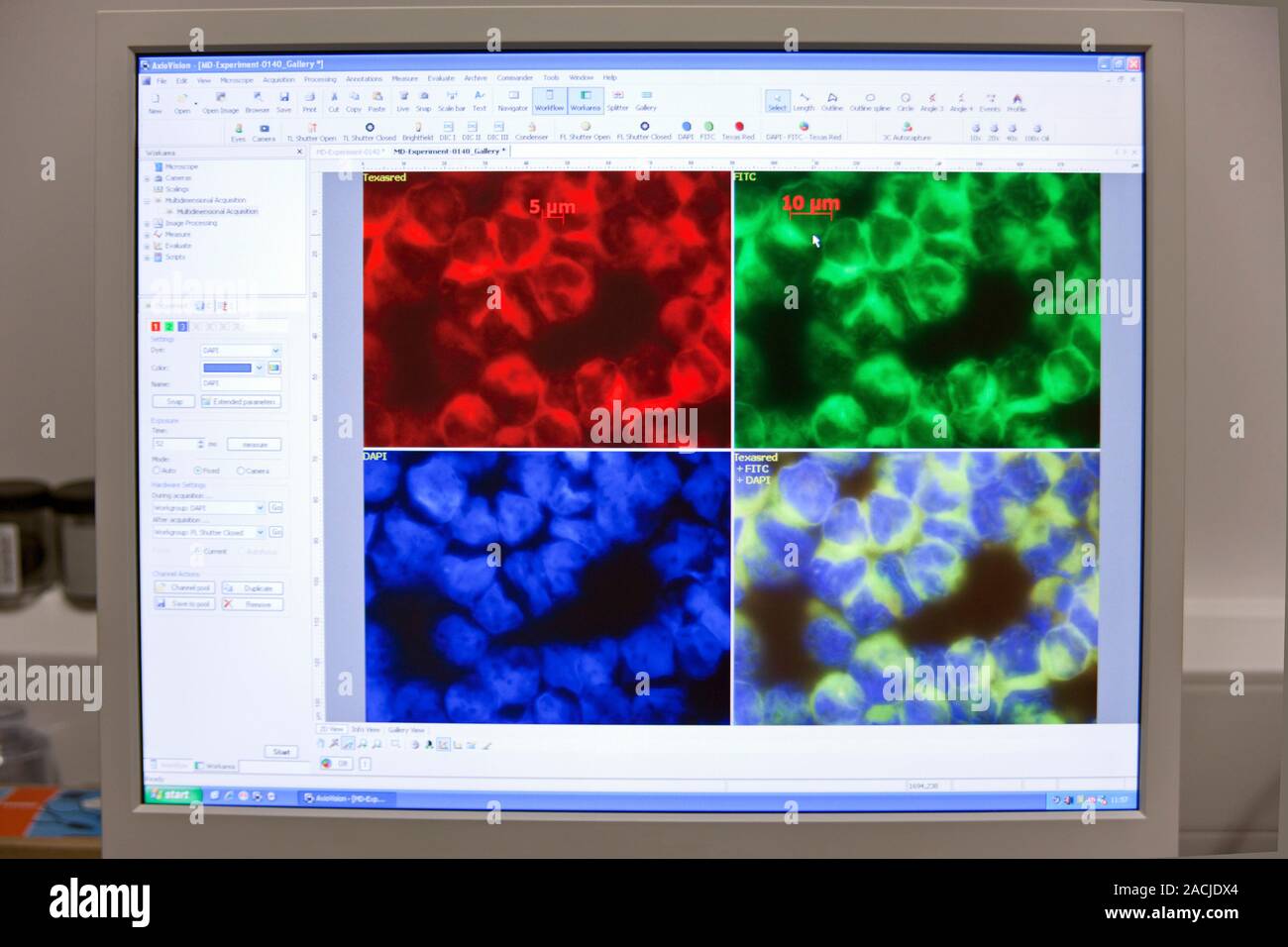 Haematology laboratory. Multiple filter light micrographs of blood ...