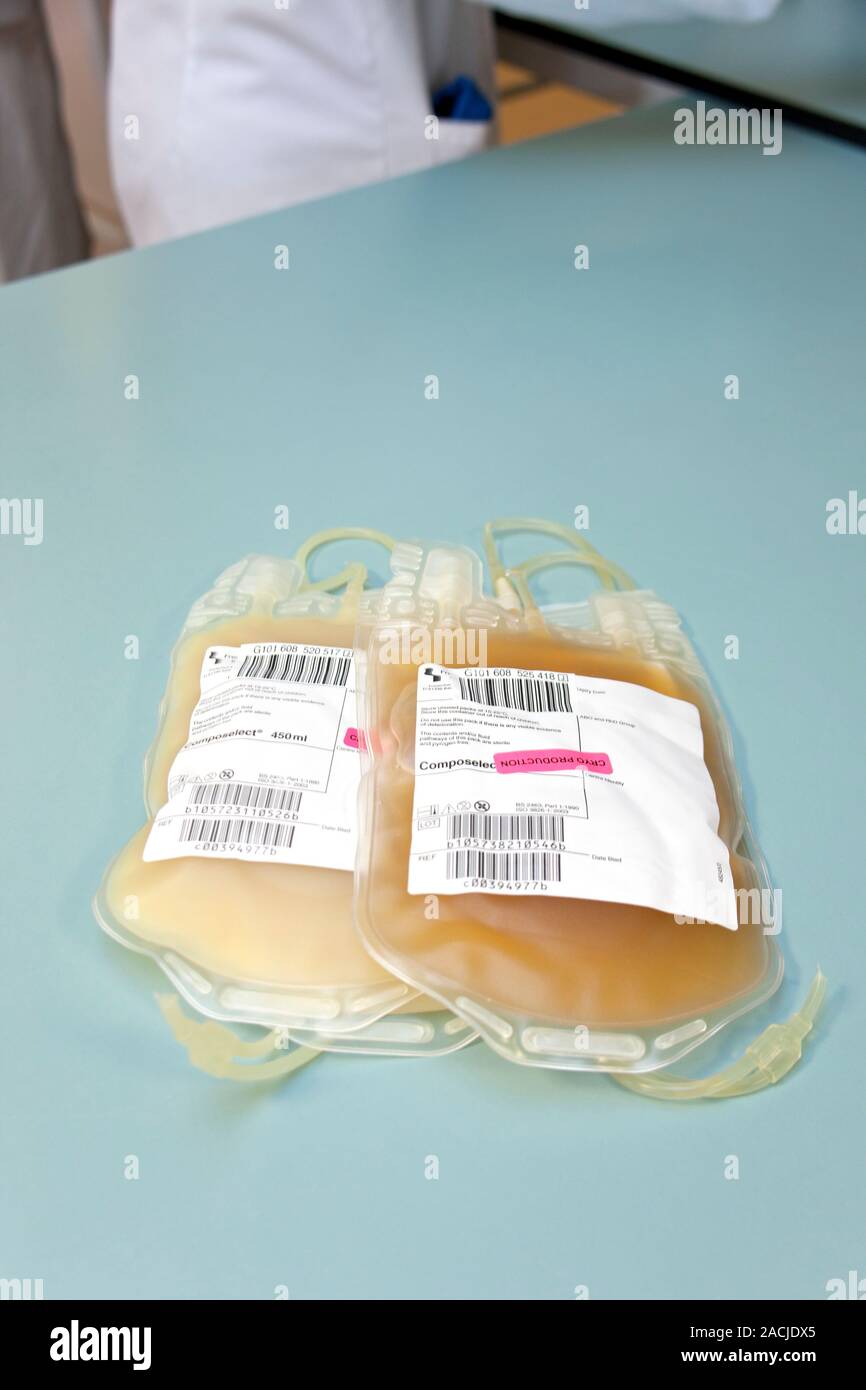Blood plasma. Close-up of bags of blood plasma that has been extracted ...