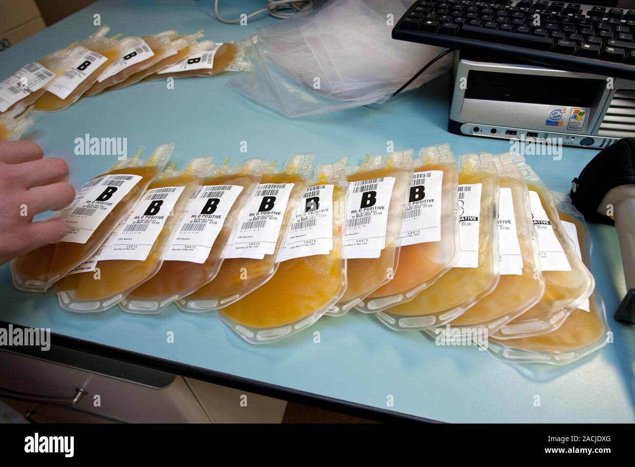 Blood plasma. Haematology technician labelling bags of blood plasma ...