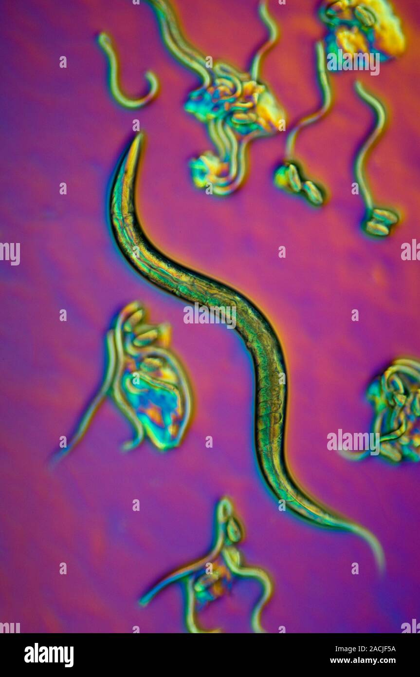 C. elegans worms. Differential interference contrast micrograph of an ...