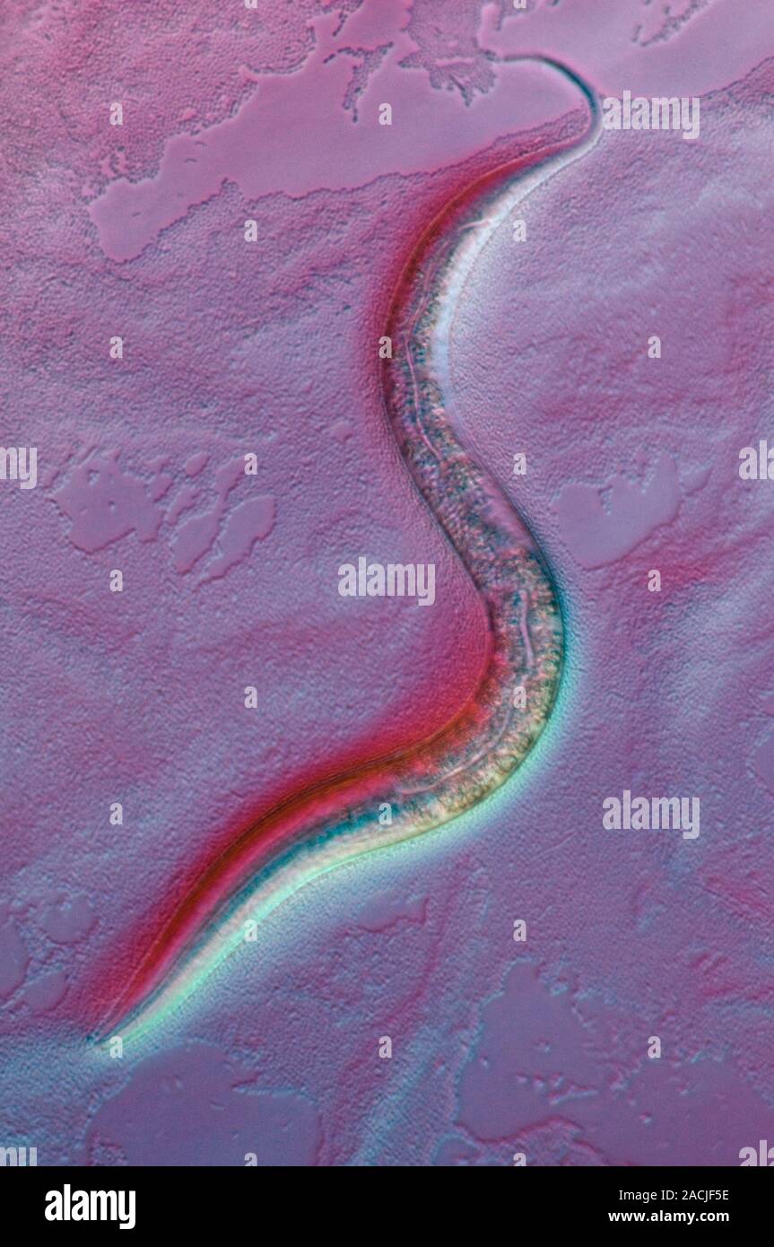 C. elegans worm. Differential interference contrast micrograph of a ...