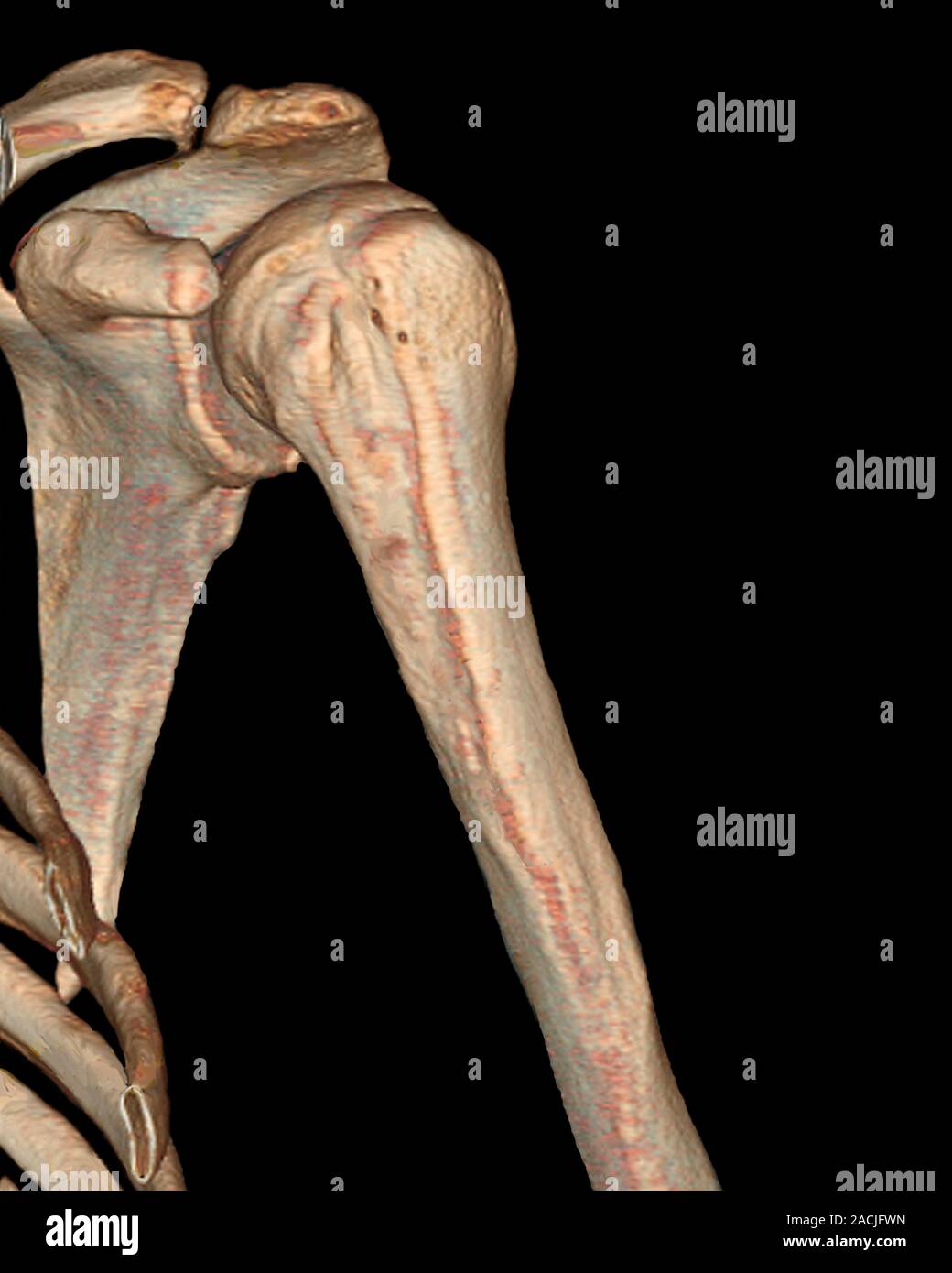 Coloured three-dimensional (3D) computed tomography (CT) scan in side view of the healthy ...
