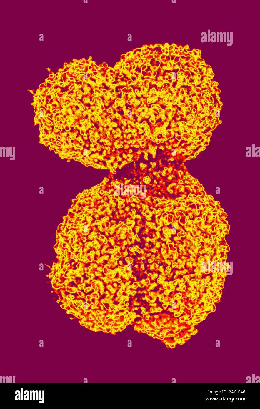 Human chromosome 16, coloured scanning electron micrograph (SEM ...