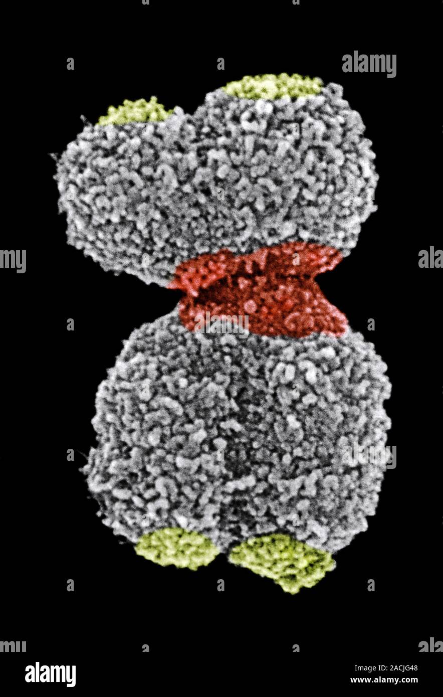 Human chromosome 16, coloured scanning electron micrograph (SEM ...
