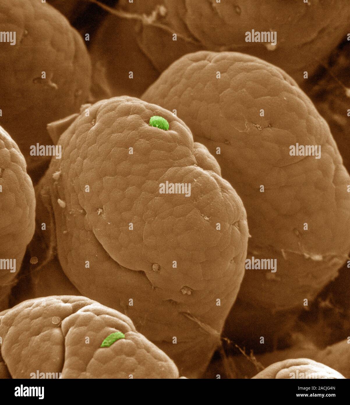 Intestinal villi cell loss, coloured scanning electron micrograph (SEM ...