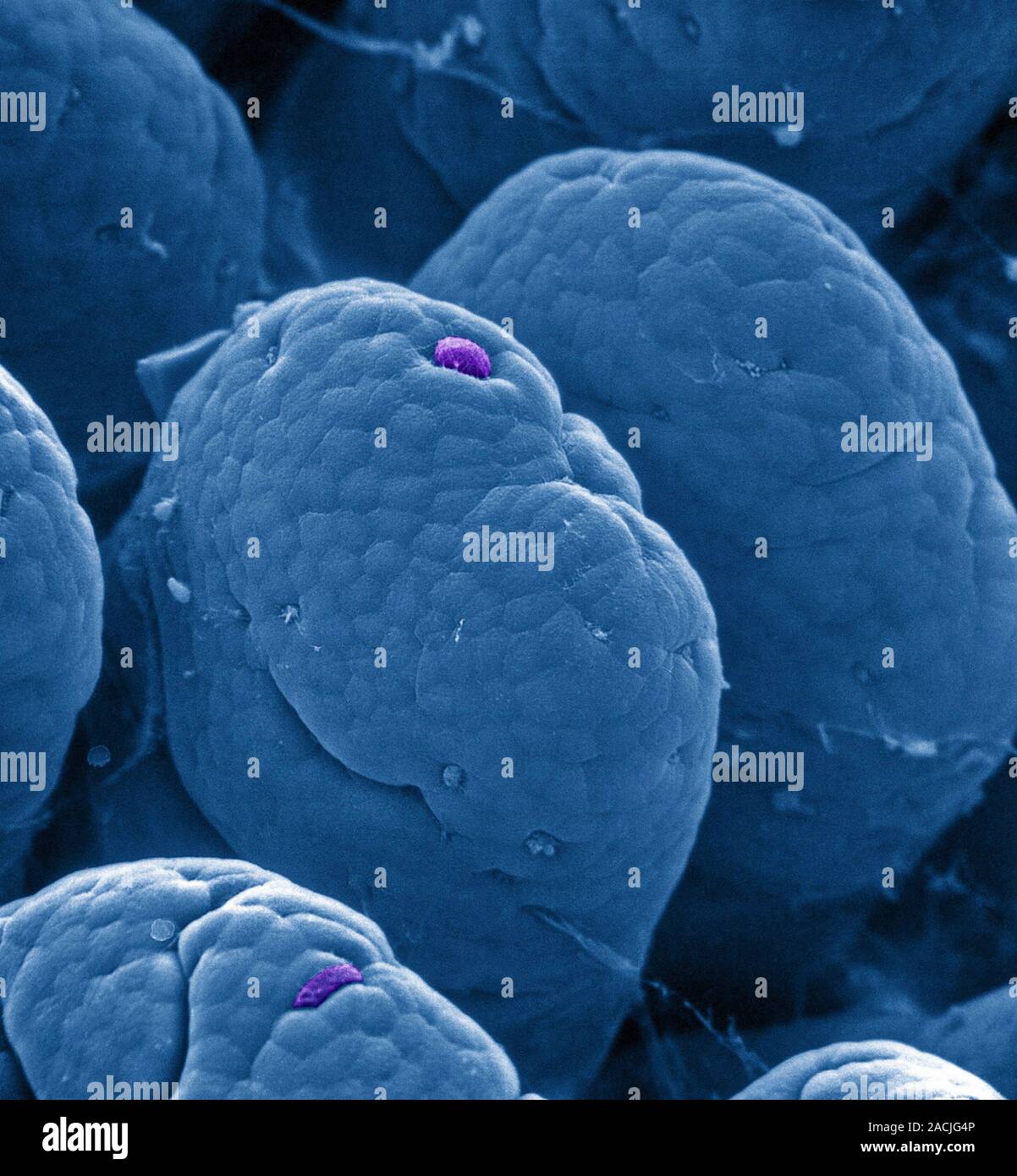 Intestinal villi cell loss, coloured scanning electron micrograph (SEM ...