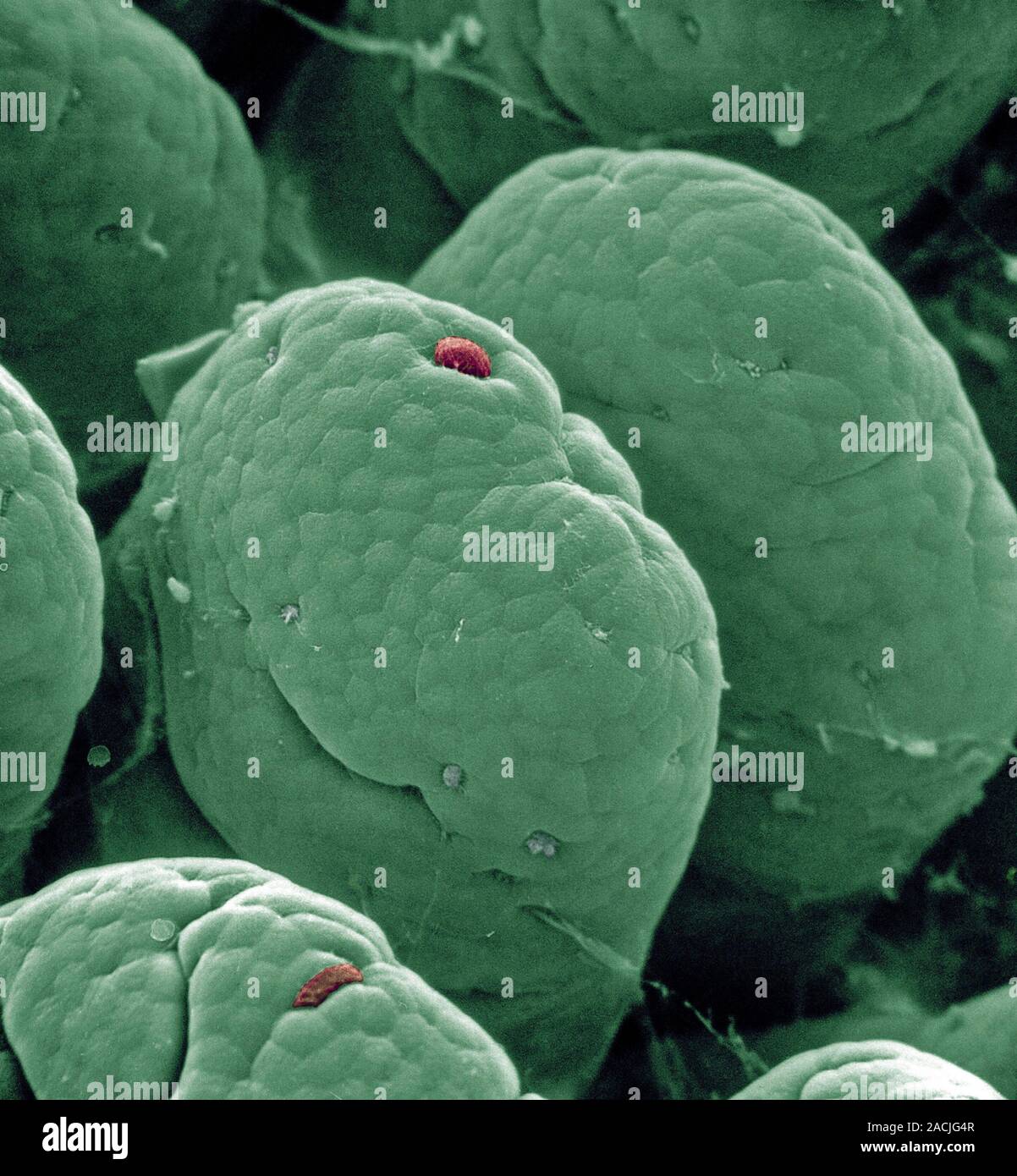 Intestinal villi cell loss, coloured scanning electron micrograph (SEM ...