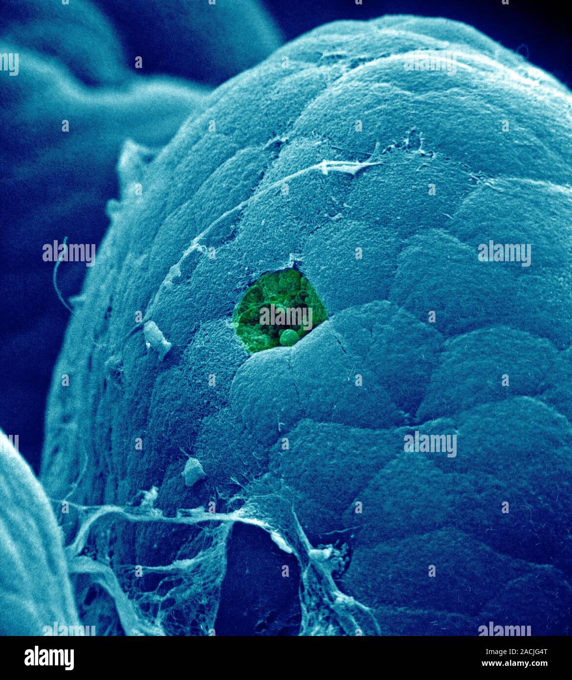 Intestinal villus cell loss, coloured scanning electron micrograph (SEM ...