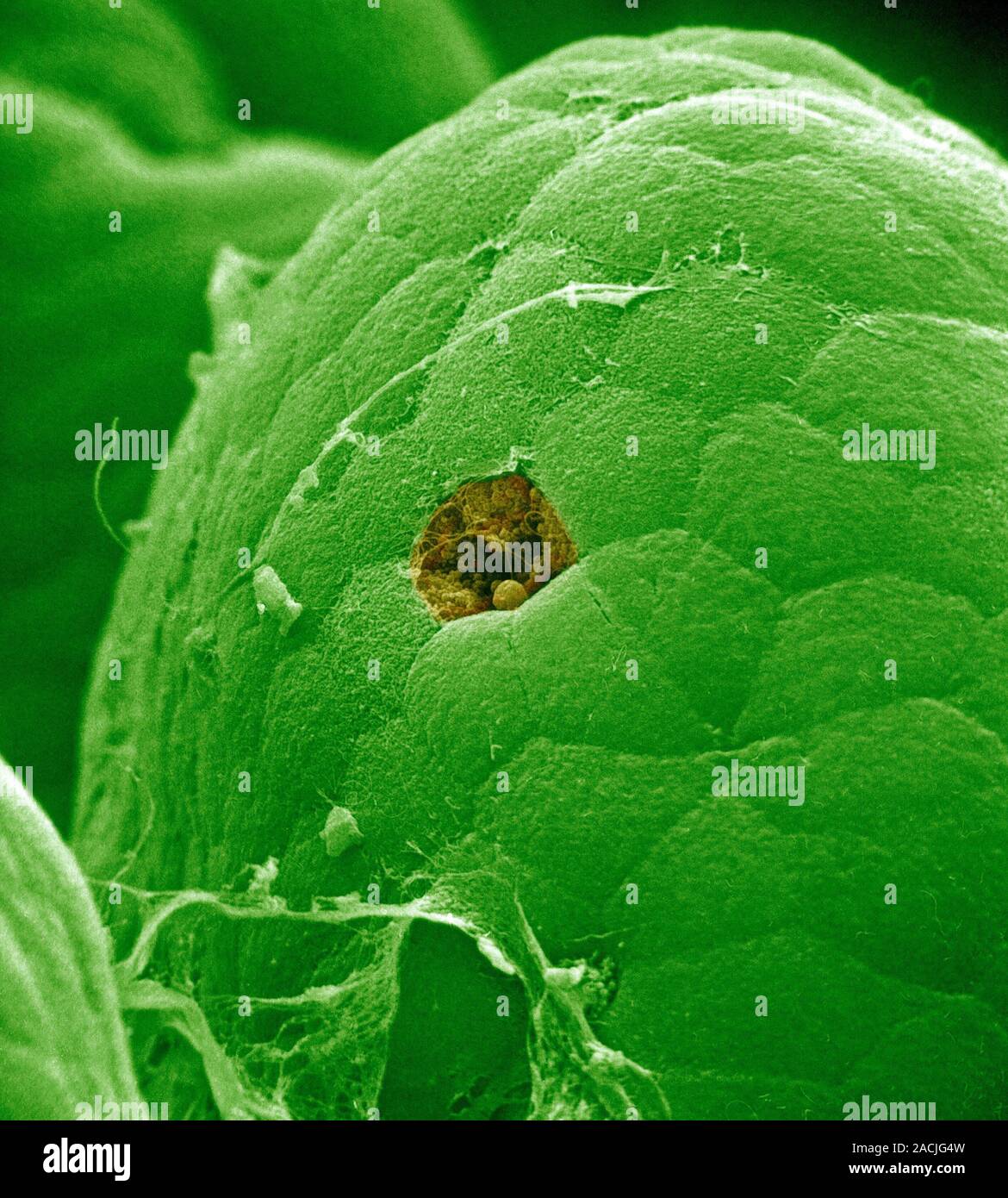 Intestinal villus cell loss, coloured scanning electron micrograph (SEM ...