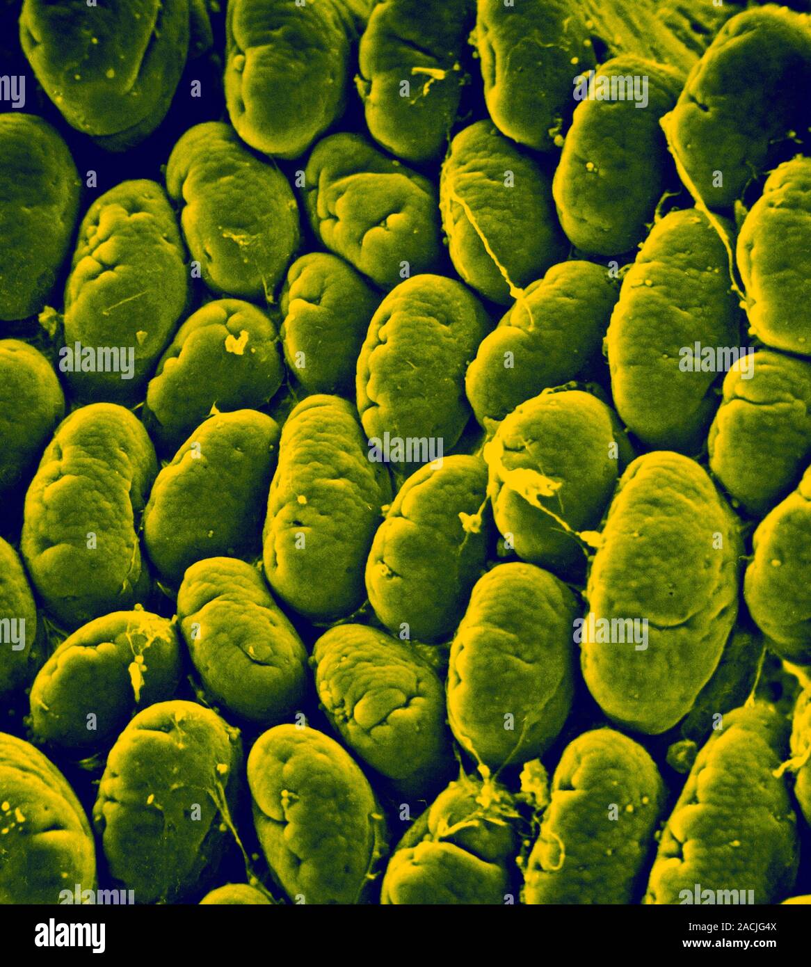 Intestinal villi, coloured scanning electron micrograph (SEM). The ...