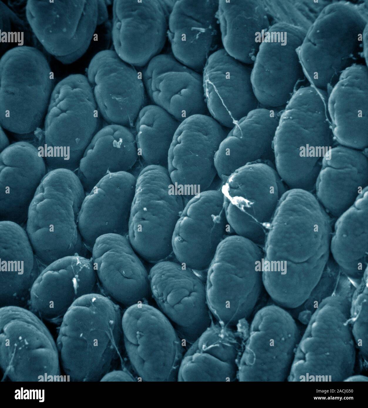 Intestinal villi, coloured scanning electron micrograph (SEM). The ...