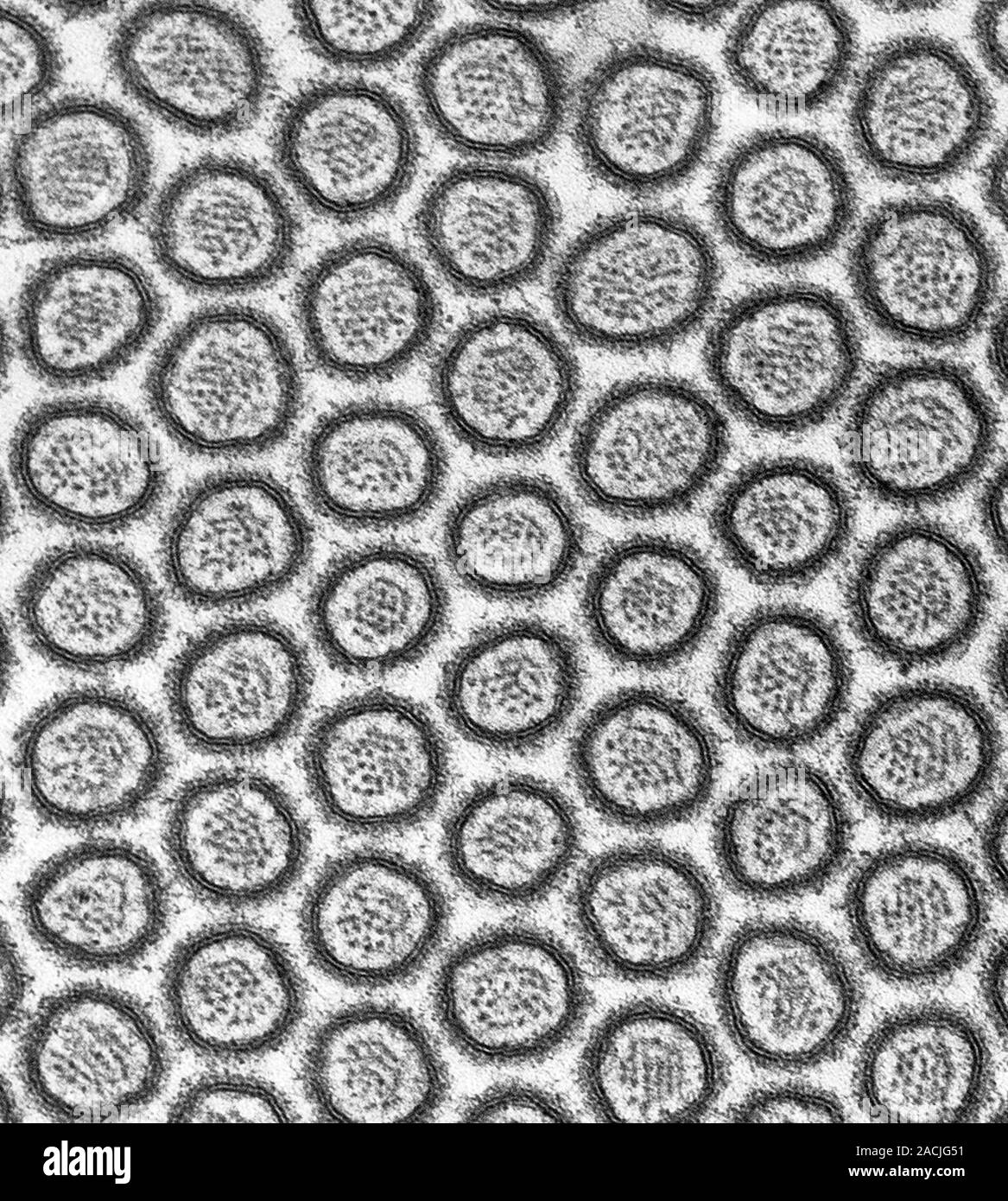 Intestinal microvilli, transmission electron micrograph (TEM). The ...