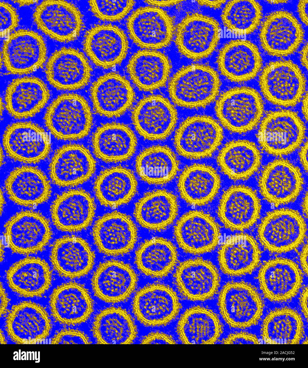 Intestinal microvilli, coloured transmission electron micrograph (TEM ...