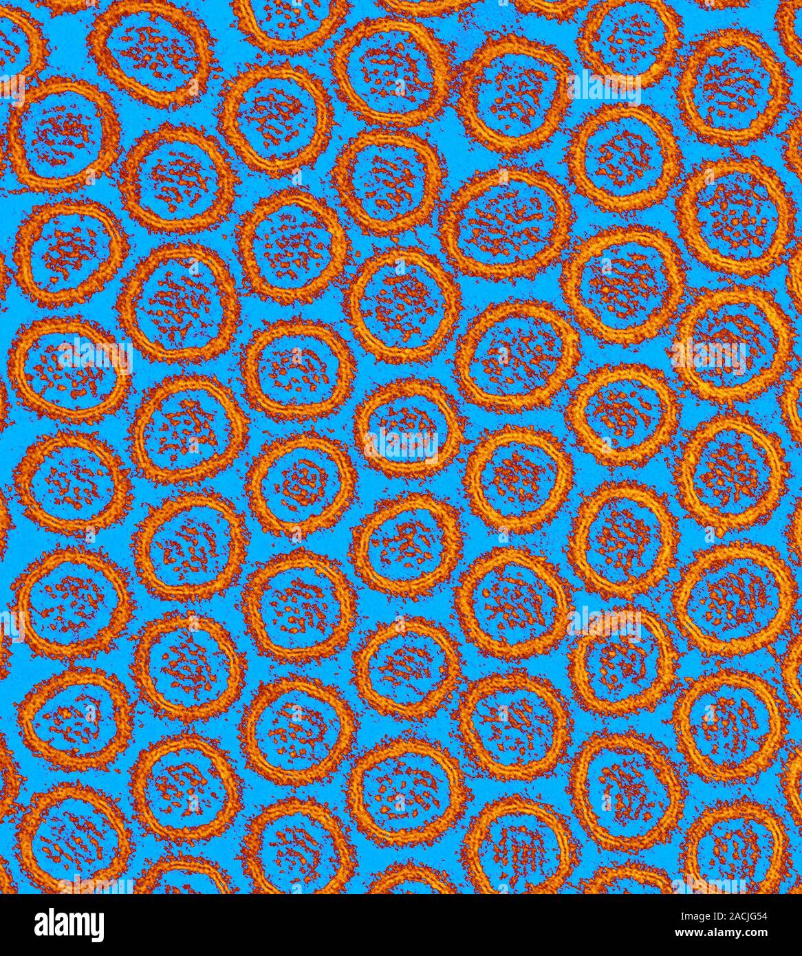 Intestinal microvilli, coloured transmission electron micrograph (TEM ...