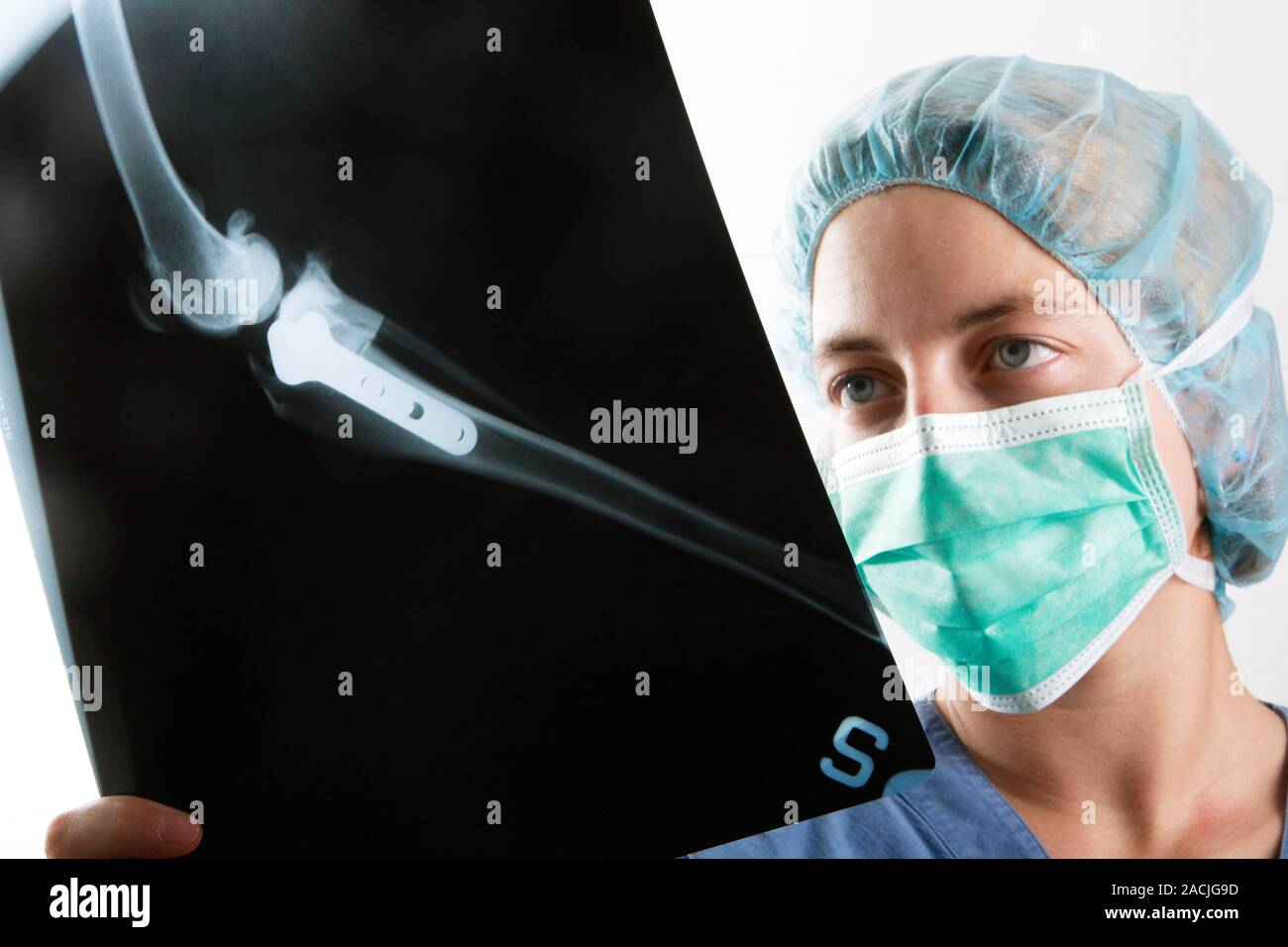 Vet examining an X-ray of a dog. This is an X-ray of a knee implant ...