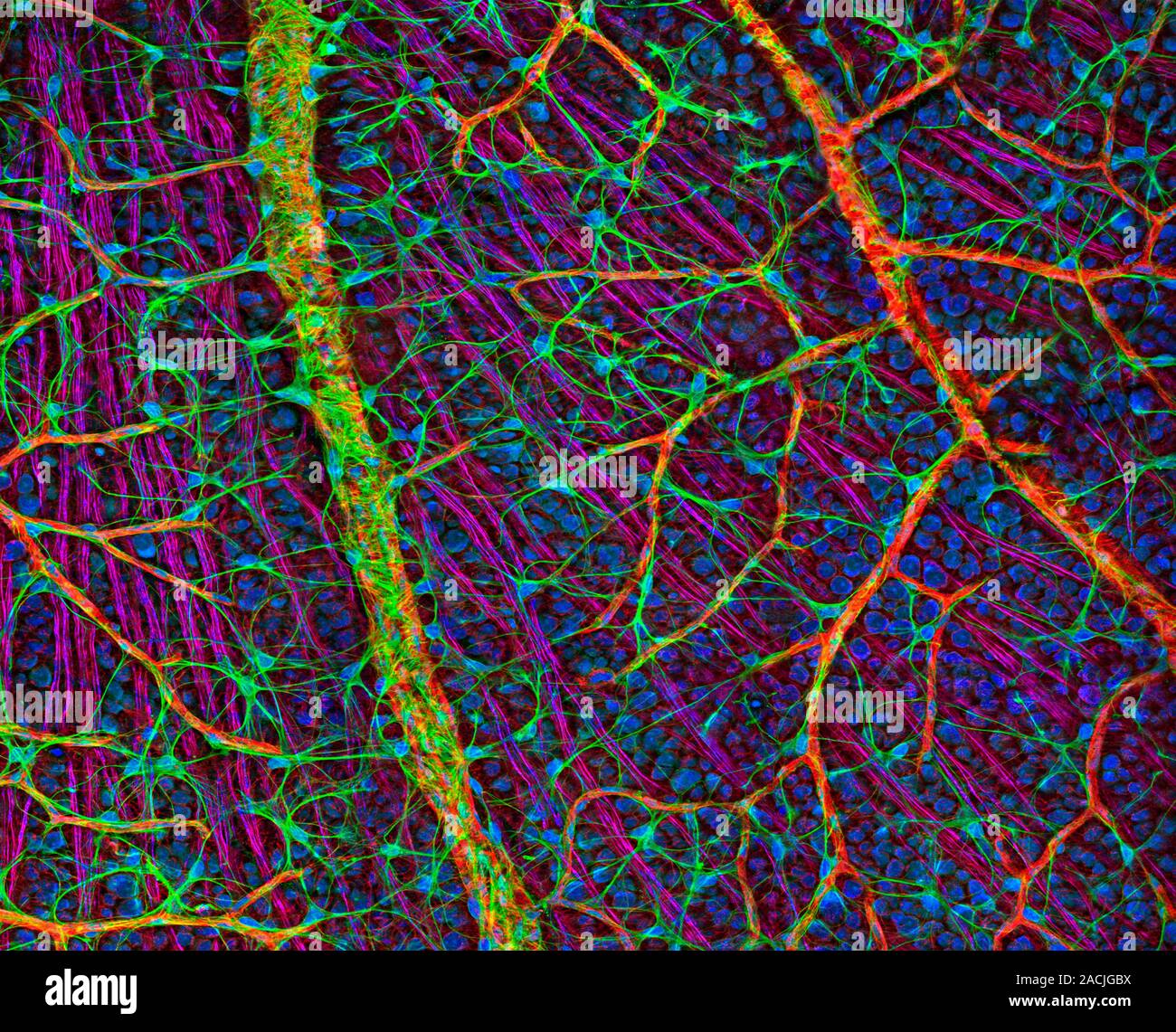 Retina blood vessels and nerve cells. Light micrograph showing the ...