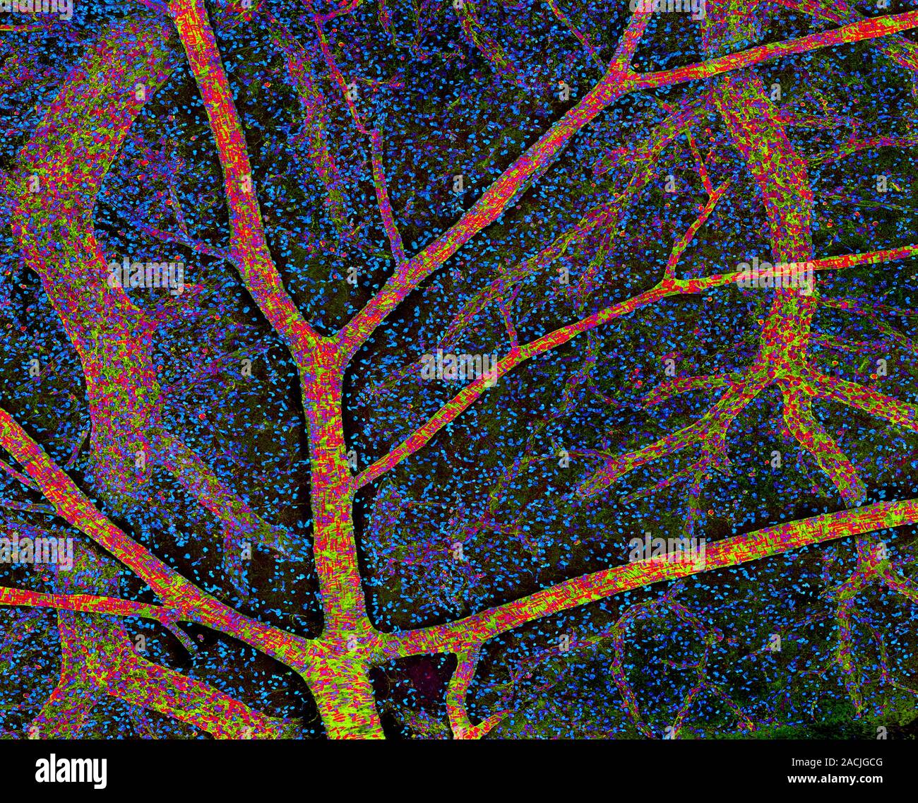 Brain tissue blood supply. Light micrograph of a section through cortex ...