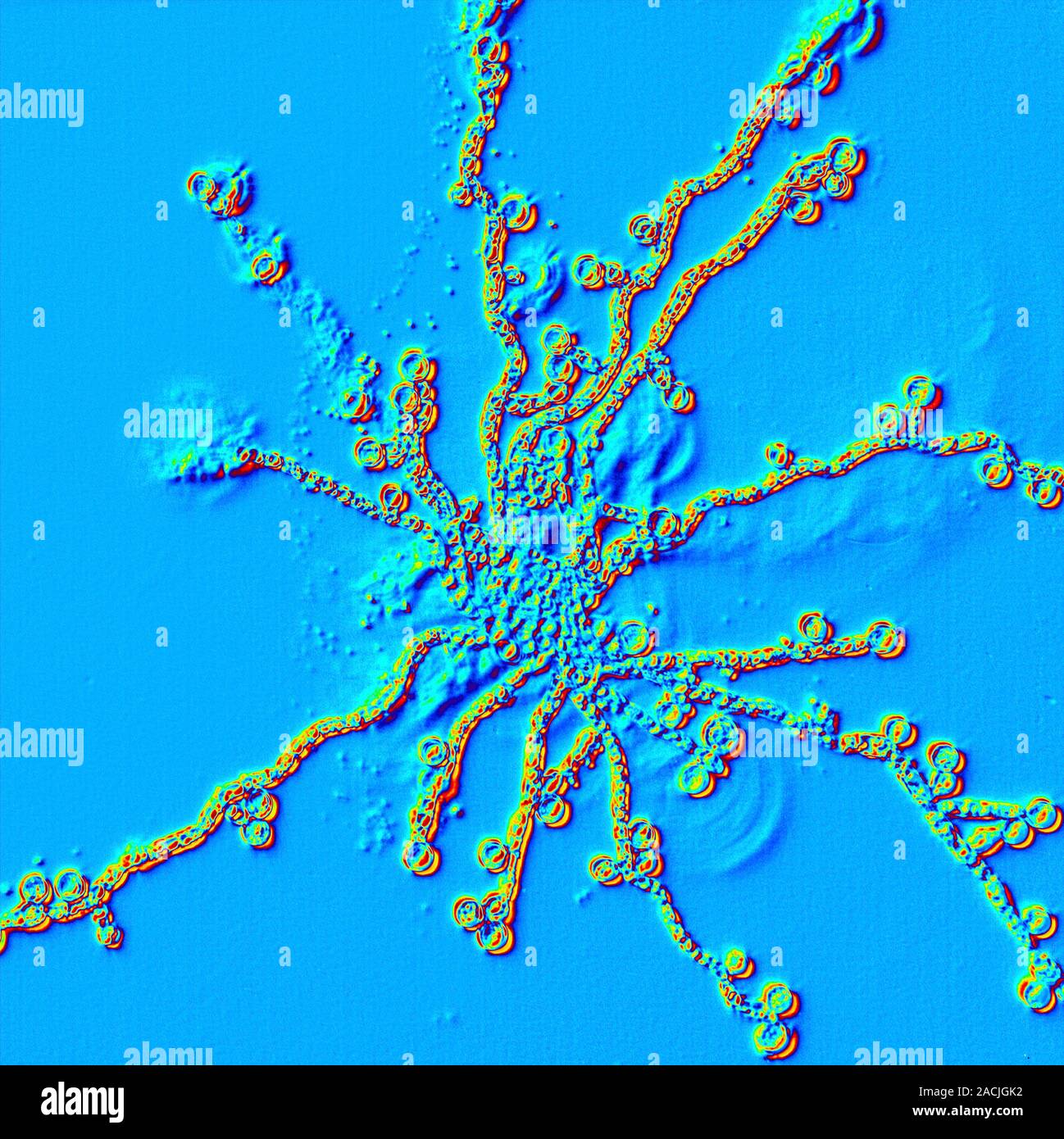 Candida albicans fungus. False color light micrograph of cells of the ...