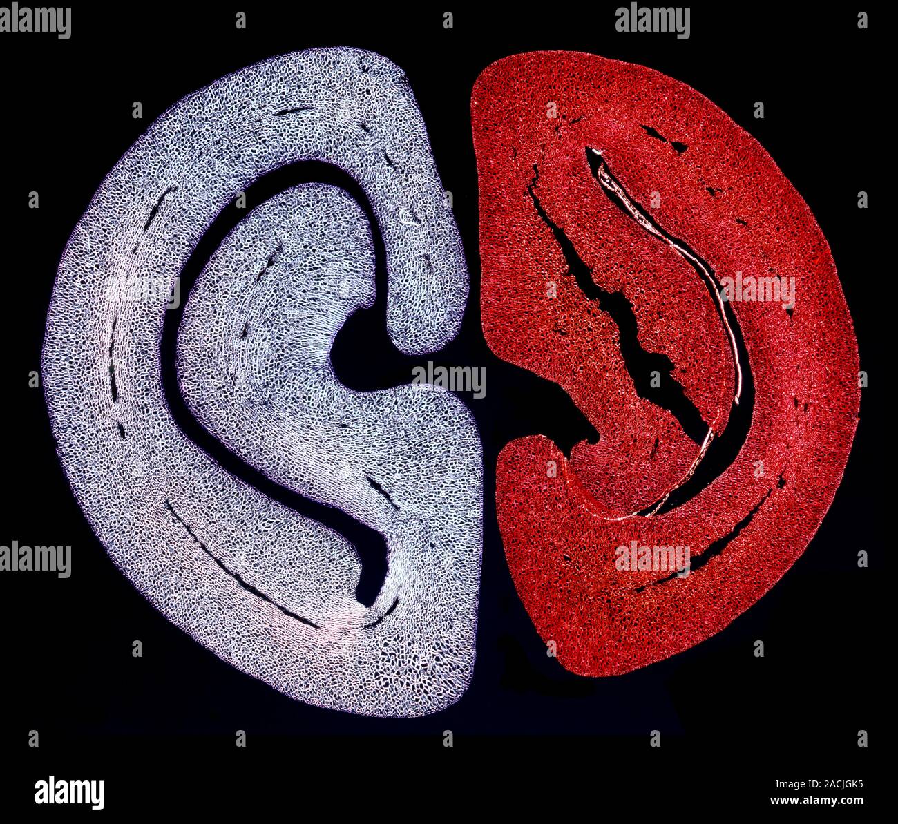 Polarised light micrograph of coffee beans. Shown are cross sections of ...